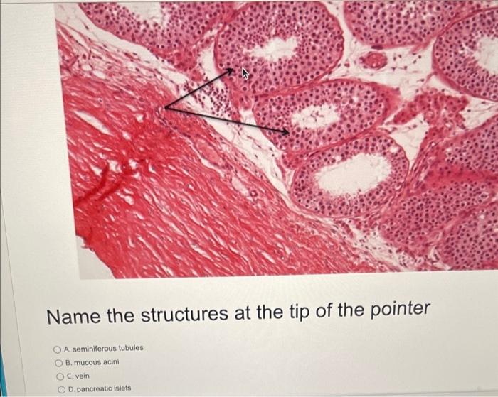 Solved Name the structures at the tip of the pointer A. | Chegg.com