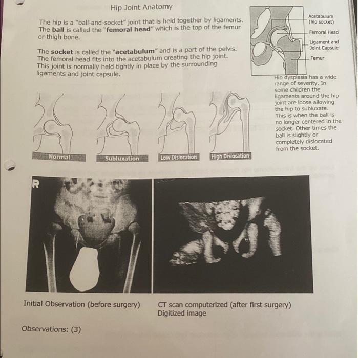 Solved Hip Joint Anatomy The hip is a "ball-and-socket" | Chegg.com