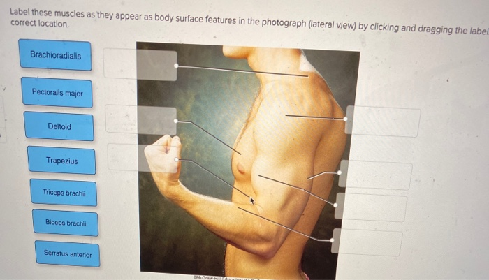 Solved Label these muscles as they appear as body surface | Chegg.com
