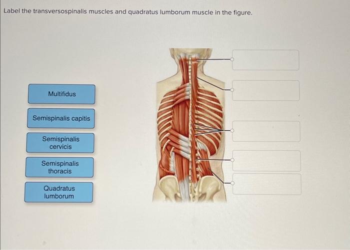 Solved Label the transversospinalis muscles and quadratus | Chegg.com
