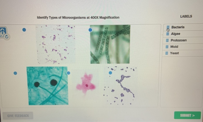 Solved LABELS Identify Types of Microorganisms at 400X | Chegg.com