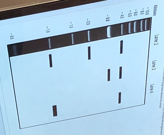 Solved Restriction mapping of a linear piece of DNA | Chegg.com