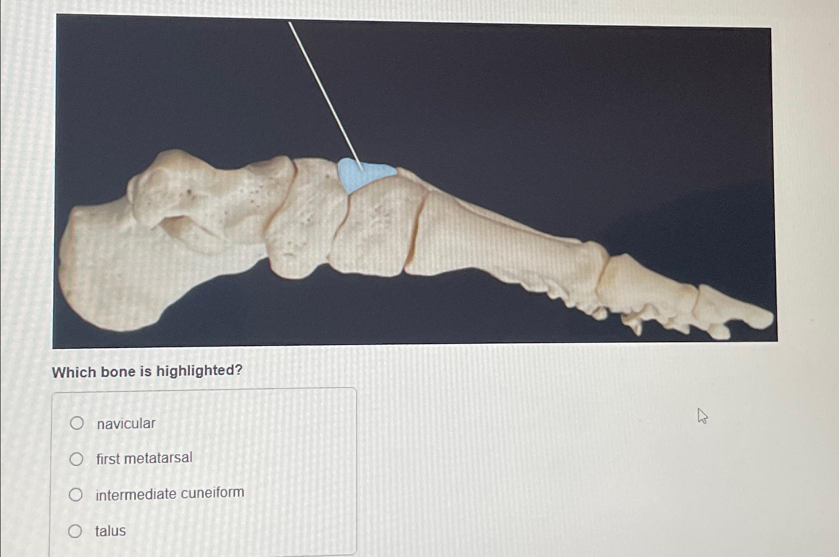 Solved Which bone is highlighted?navicularfirst | Chegg.com