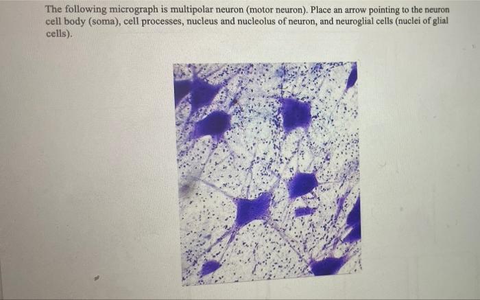 Solved The following micrograph is multipolar neuron (motor | Chegg.com
