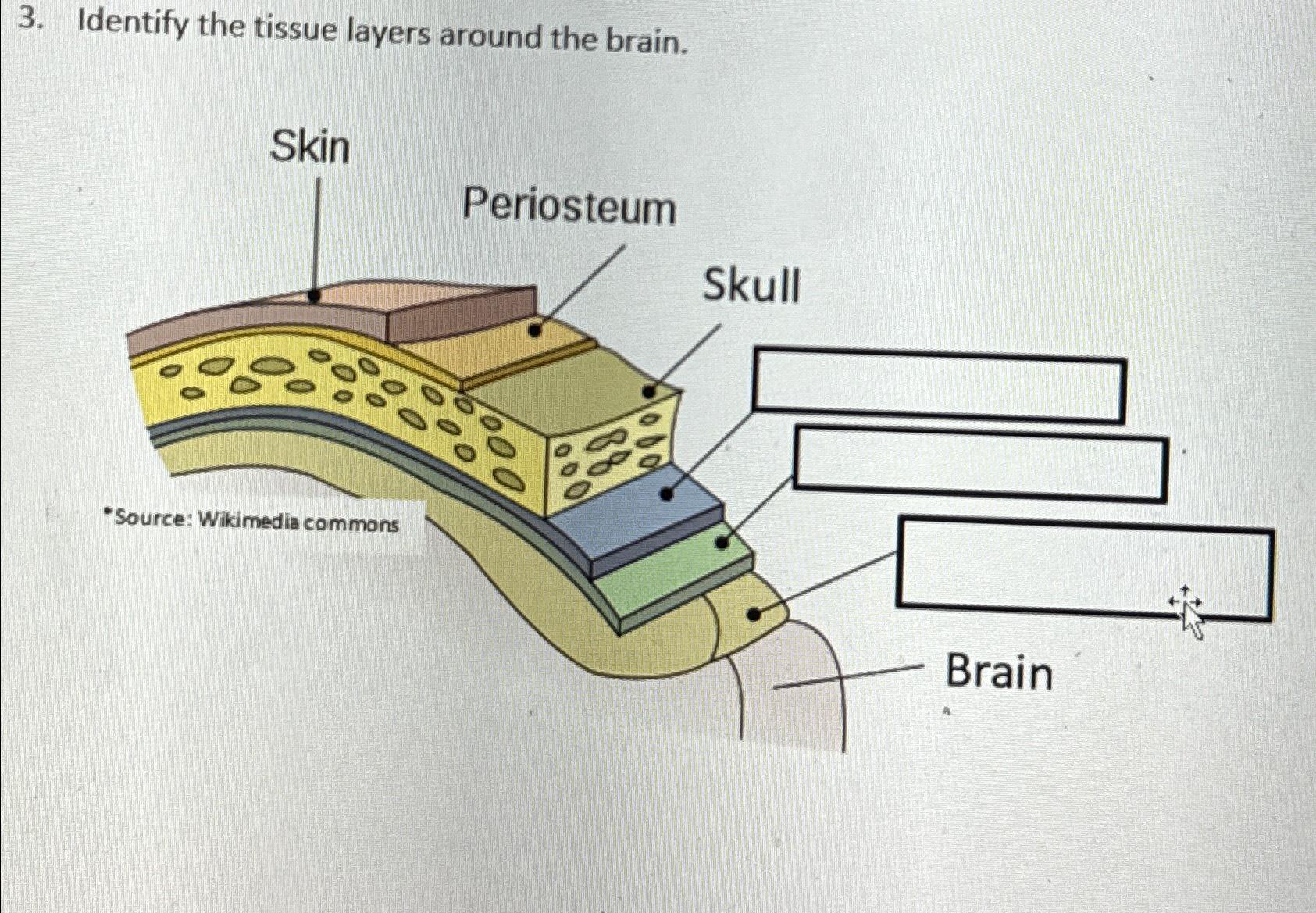 Solved Identify the tissue layers around the brain. | Chegg.com