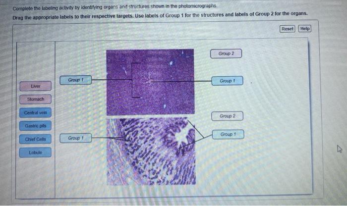 Solved Complete the labeling activity by identifying organs | Chegg.com