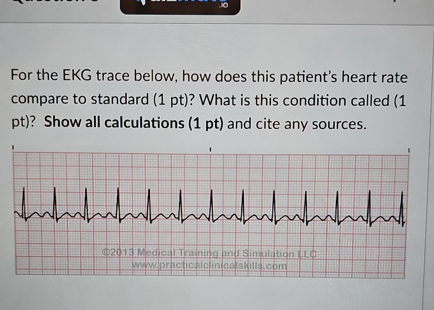 Solved For the EKG trace below, how does this patient's | Chegg.com