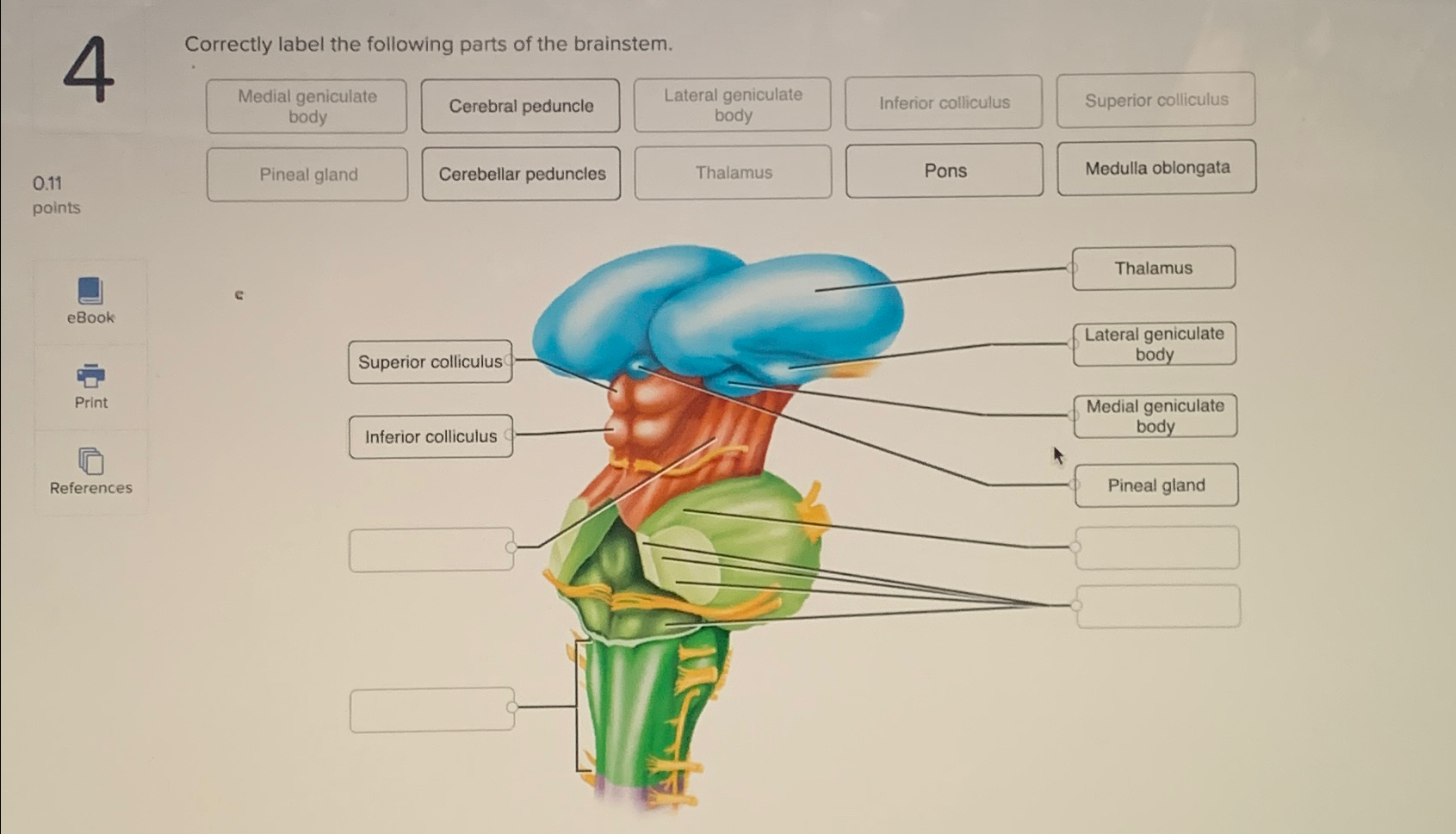 Solved Correctly label the following parts of the | Chegg.com