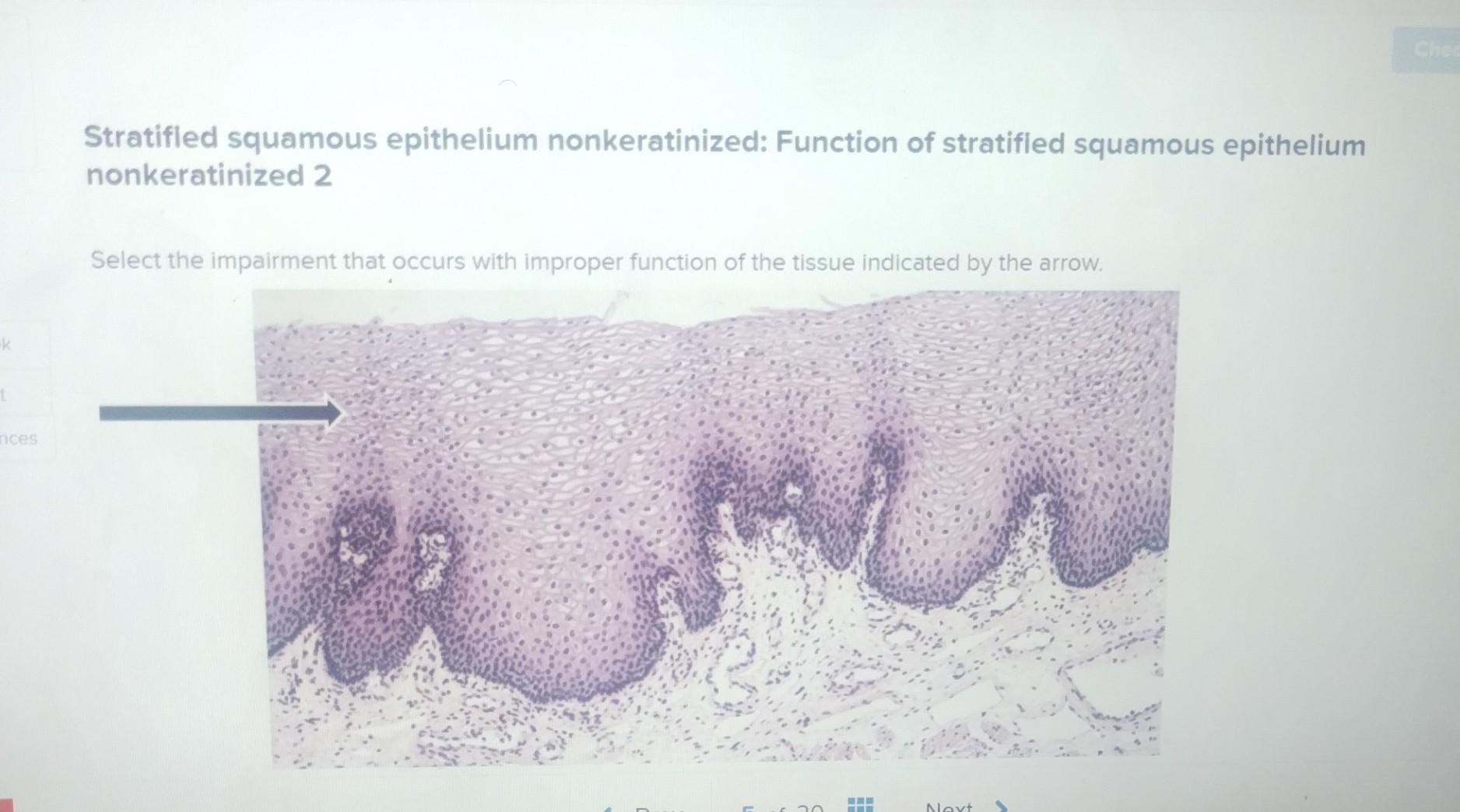 Solved Stratifled squamous epithelium nonkeratinized: | Chegg.com