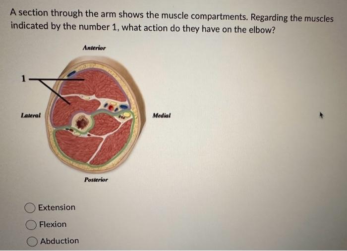 Solved A section through the arm shows the muscle | Chegg.com