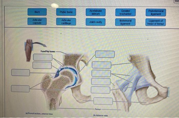 Solved Articular cartilage Articular capsule Joint space | Chegg.com
