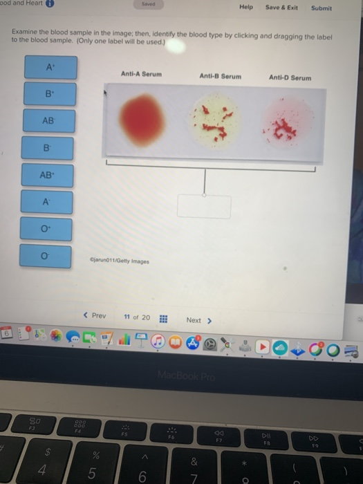 Solved ood and Heart Help Save & Exit Submit Examine the | Chegg.com
