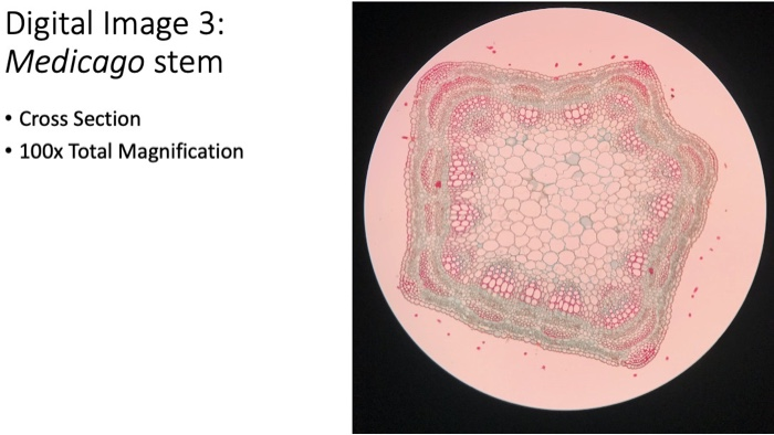 Solved Digital Image 3: Medicago stem • Cross Section • 100x | Chegg.com
