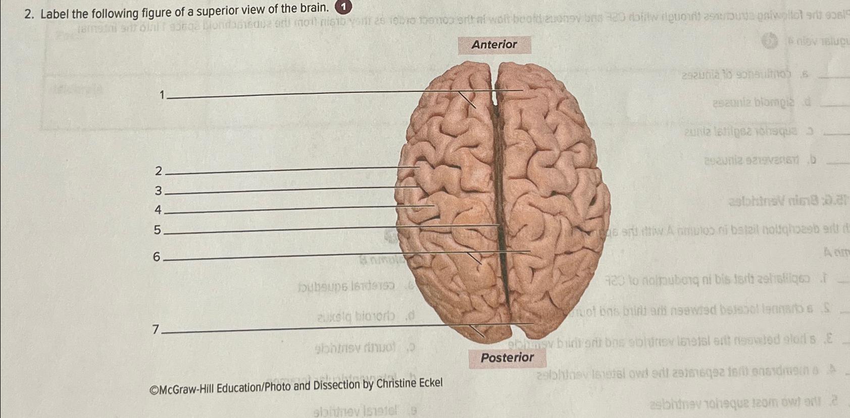 Solved Label the following figure of a superior view of the | Chegg.com