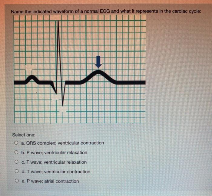 Solved Muscles with either parallel or fusiform arrangments | Chegg.com