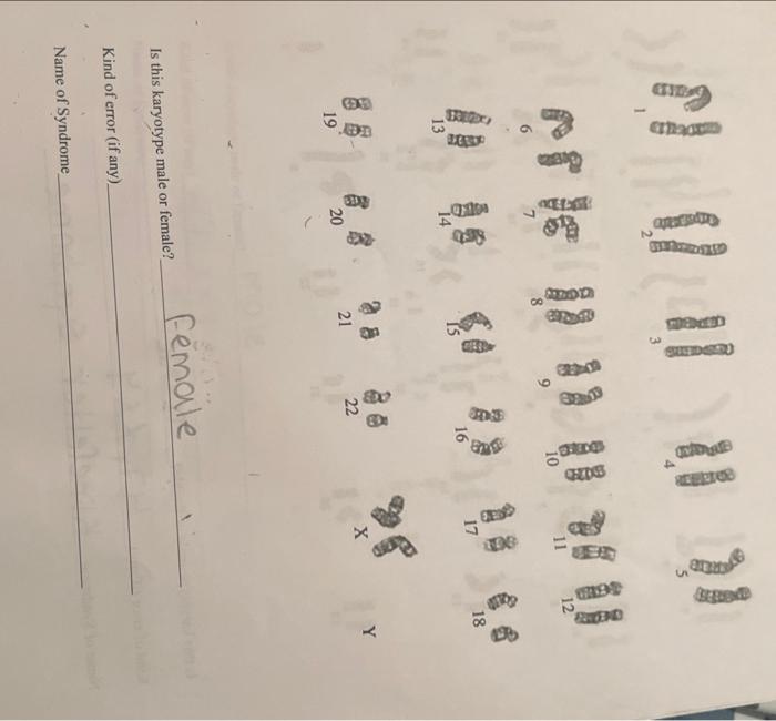 Solved \r\nIs this karyotype male or female? Kind of error | Chegg.com