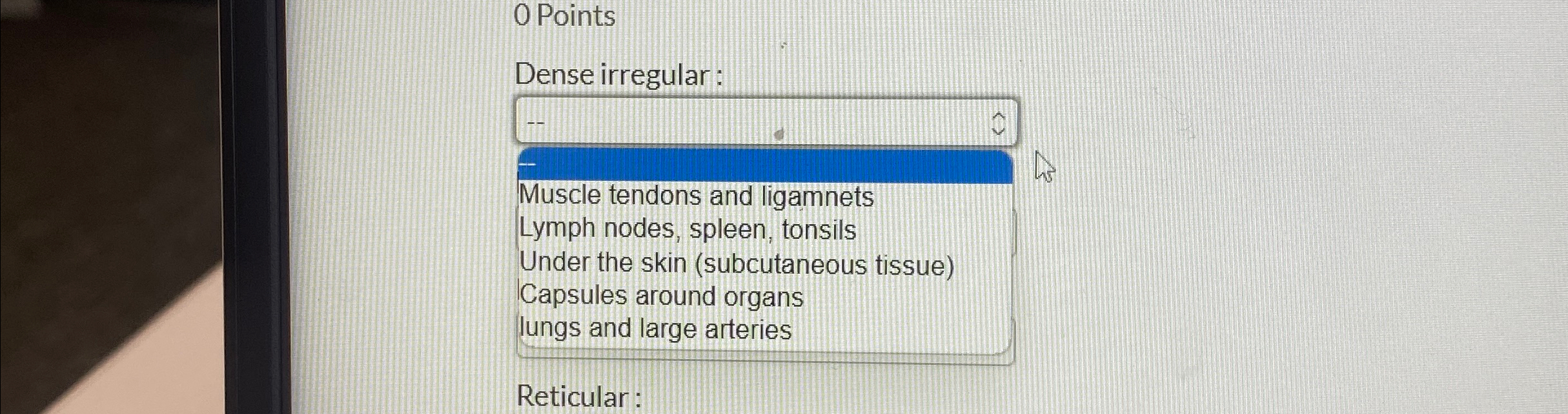 Solved OPointsDense irregular:Muscle tendons and | Chegg.com