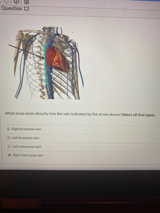 Solved Question 12 What areas drain directly into the vein | Chegg.com