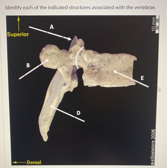 Solved Identify each of the indicated structures associated | Chegg.com