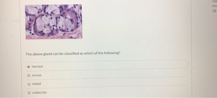 Solved In the glandular tissue above, the tissue outlined in | Chegg.com