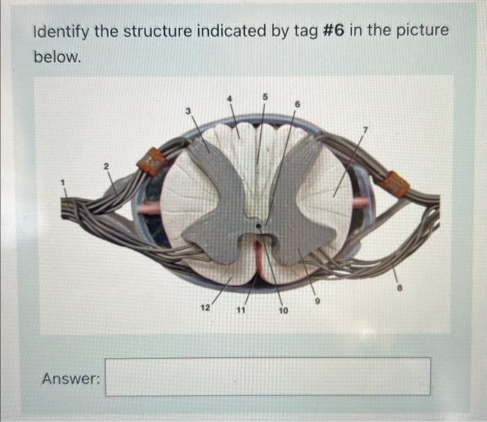 Solved Identify the structure highlighted green in the | Chegg.com