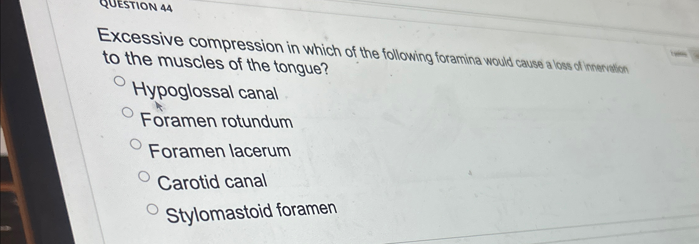 Solved QUESTION 44Excessive compression in which of the | Chegg.com