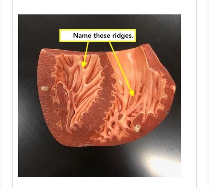 Solved Name these ridges. | Chegg.com