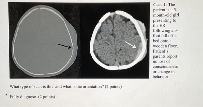 Solved Layout the flow of CSF starting at the lateral | Chegg.com