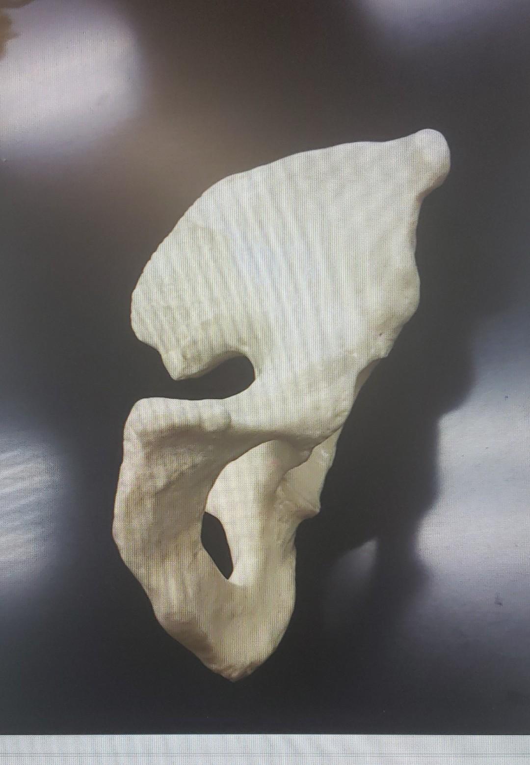 Solved pls label this hip bone | Chegg.com Solved pls label this hip bone | Chegg.com