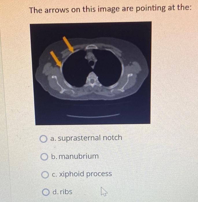 Solved The arrows on this image are pointing at the: a. | Chegg.com