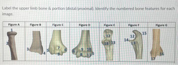 Label the upper limb bone \& portion | Chegg.com