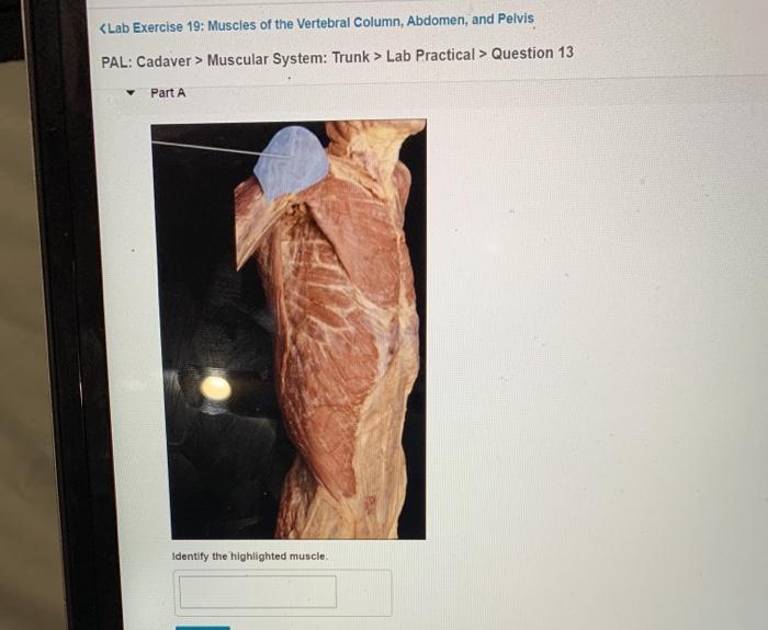 Solved Muscular System: Trunk > Lab Practical > Question 13 | Chegg.com