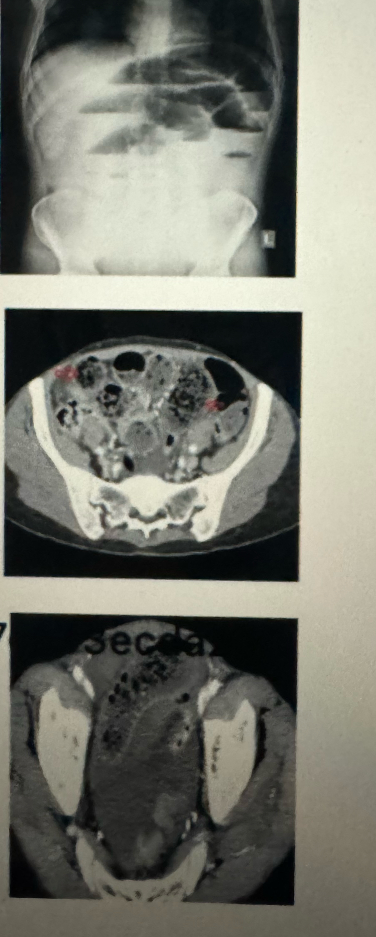 Solved Explain the the type of appearance of the disease in | Chegg.com