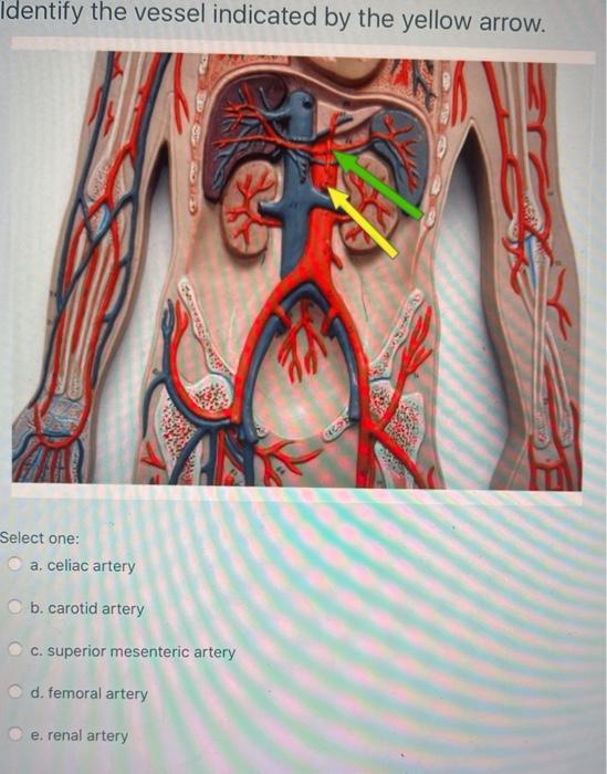 Solved Identify the vessel indicated by the yellow arrow. | Chegg.com