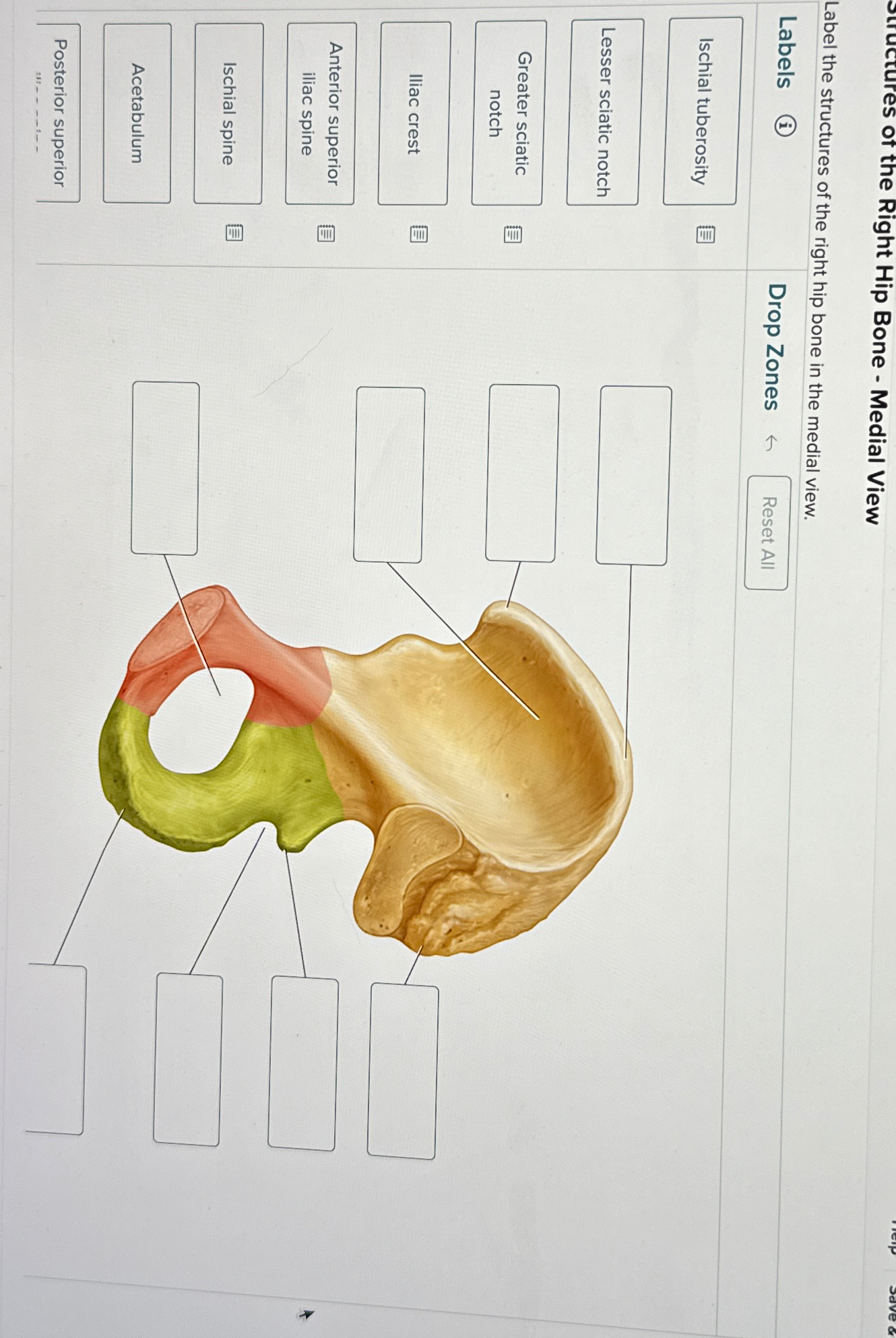 Solved structures of the Right Hip Bone - ﻿Medial ViewLabel | Chegg.com