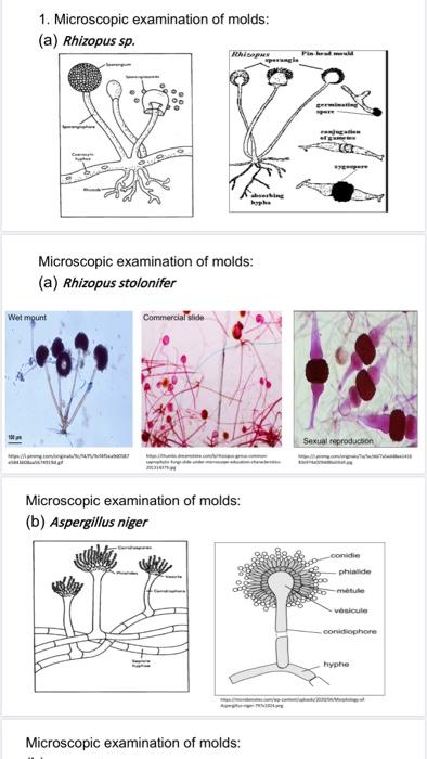 Solved Yeast Morphology and cultural characteristics c. | Chegg.com