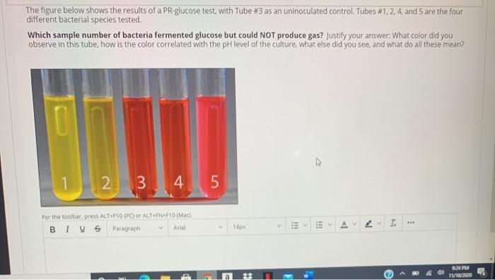 Solved The figure below shows the results of a PR-glucose | Chegg.com