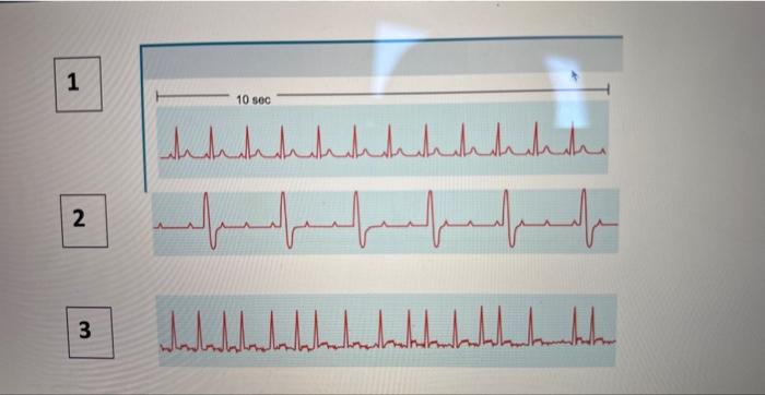 Solved Let's practice reading ECG tracings! - Review the | Chegg.com