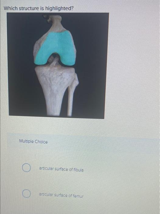 Solved Which structure is highlighted? Multiple Choice | Chegg.com