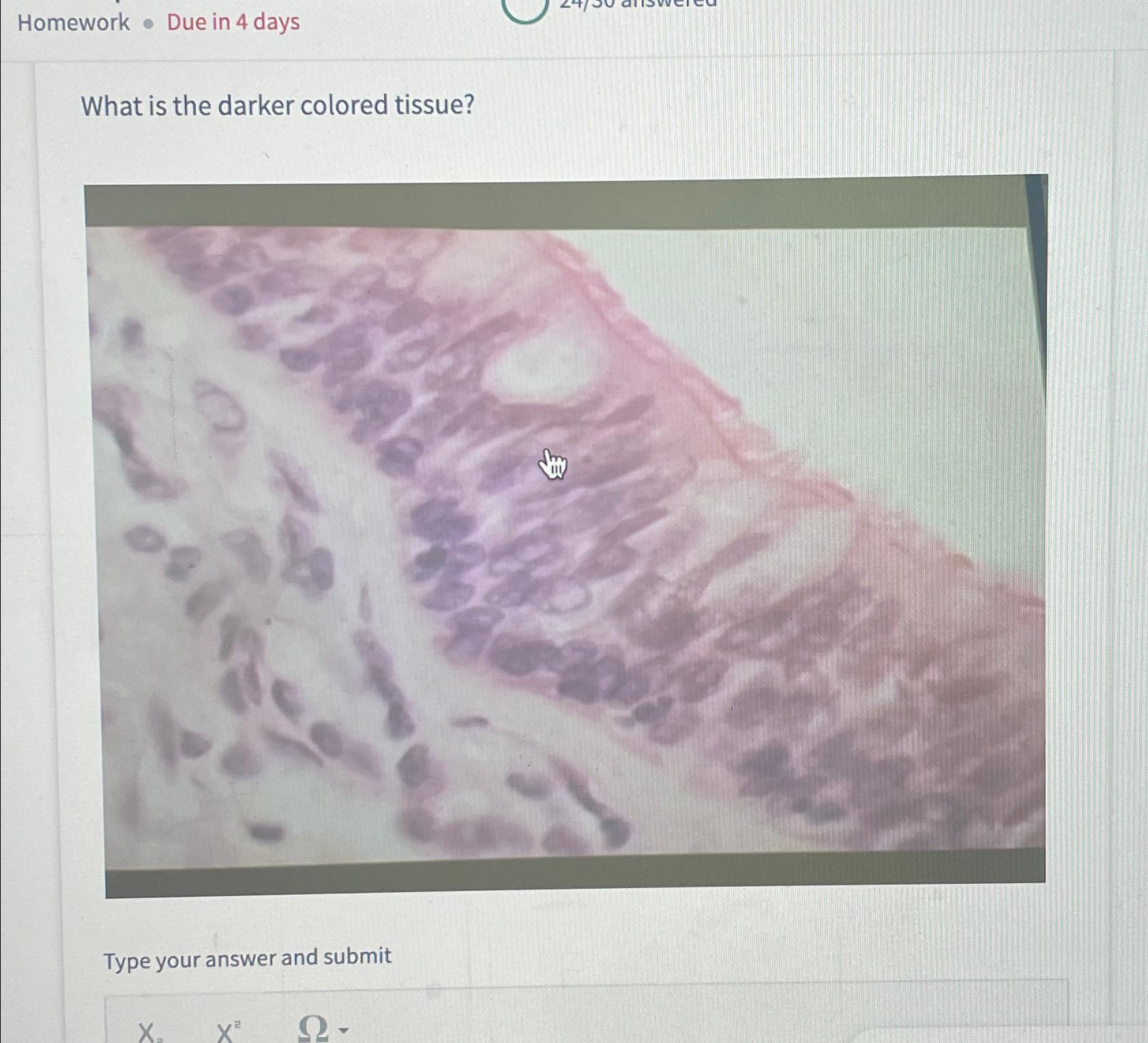 Solved What is the darker colored tissue? | Chegg.com