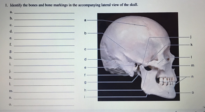 Solved 1. Identify the bones and bone markings in the | Chegg.com