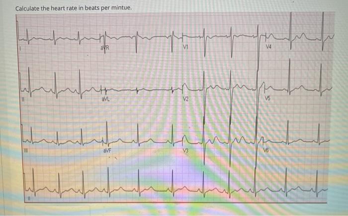 Solved Calculate the heart rate in beats per mintue. m Het | Chegg.com