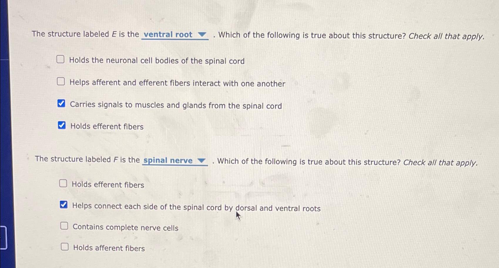 Solved The structure labeled E is the ventral root grad. | Chegg.com