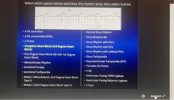 Solved Select which option below describes this rhythm | Chegg.com
