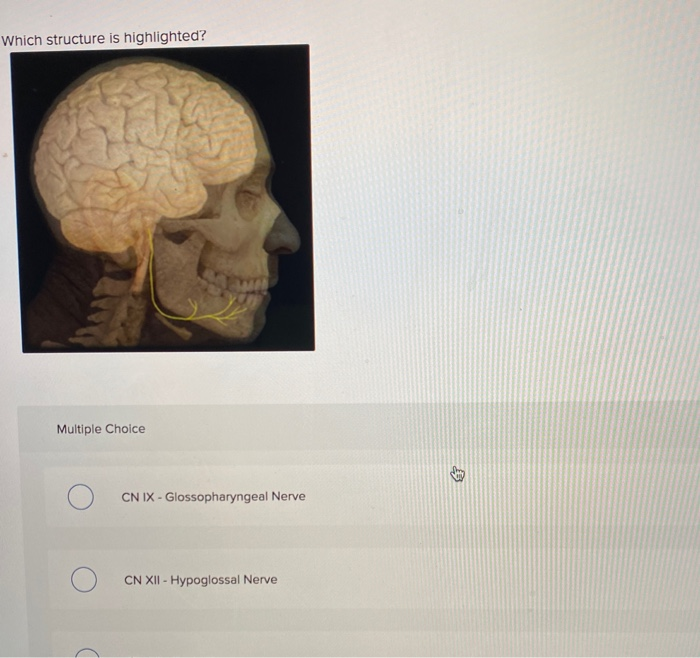 Solved Which structure is highlighted? Multiple Choice CN IX | Chegg.com