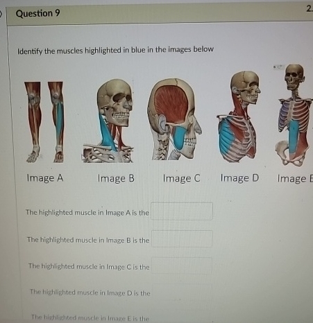 Solved Question 92.Identify the muscles highlighted in blue | Chegg.com
