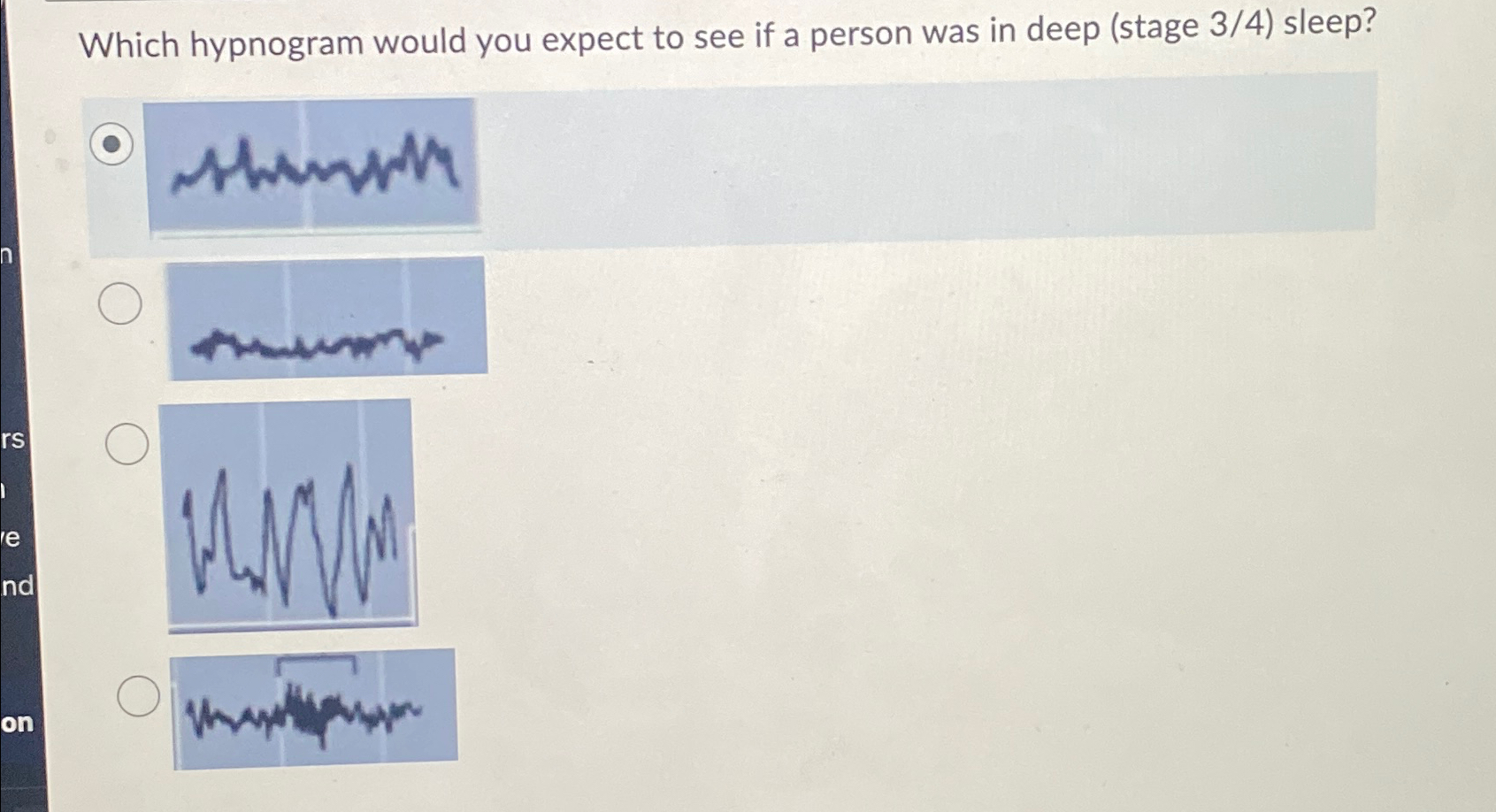 Solved Which hypnogram would you expect to see if a person | Chegg.com