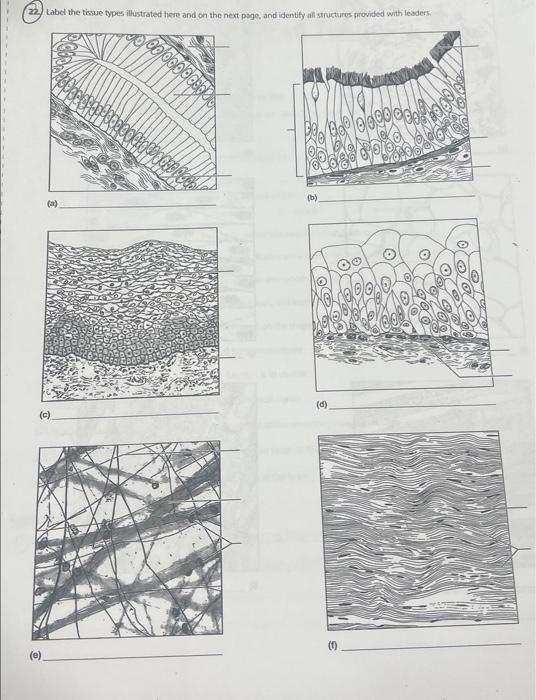 Solved 22. Label the tissue types illustrated here and on | Chegg.com