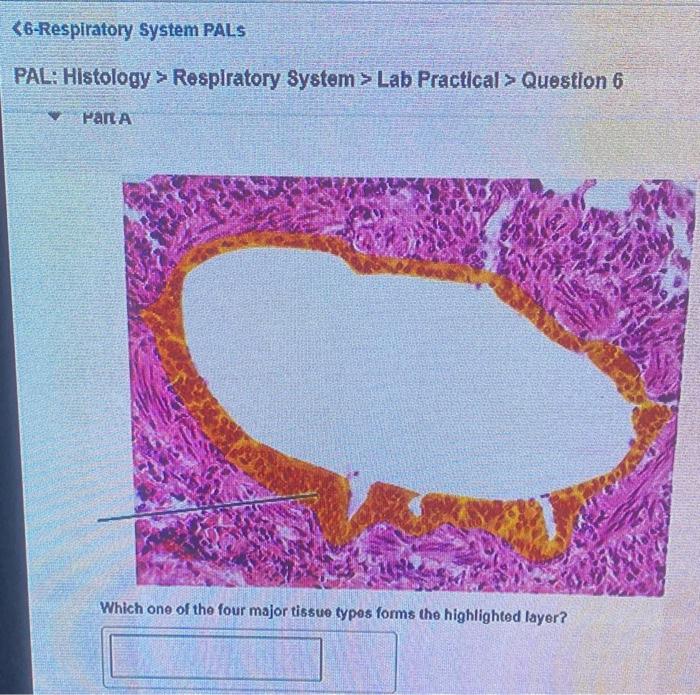 Solved 〈6-Respiratory system PALs PAL:Histology > | Chegg.com