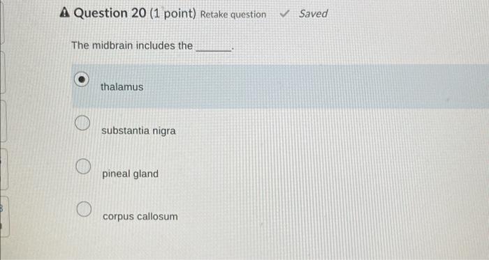 Solved A Question 20 (1 point) Retake question Saved The | Chegg.com